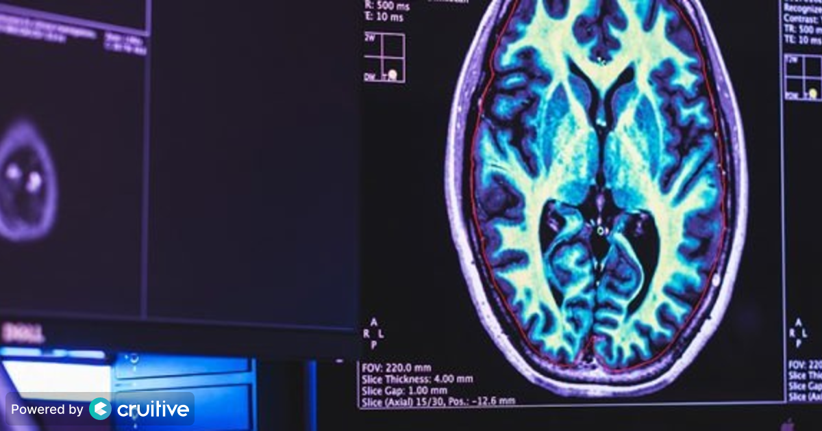 Spontaneous application